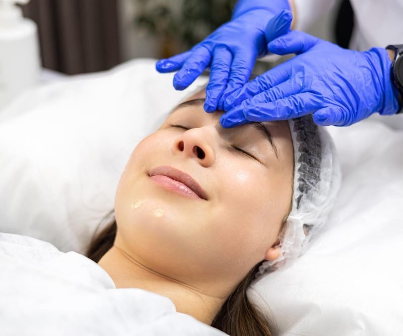 Micro Needling - letsaesthetics.co.uk
